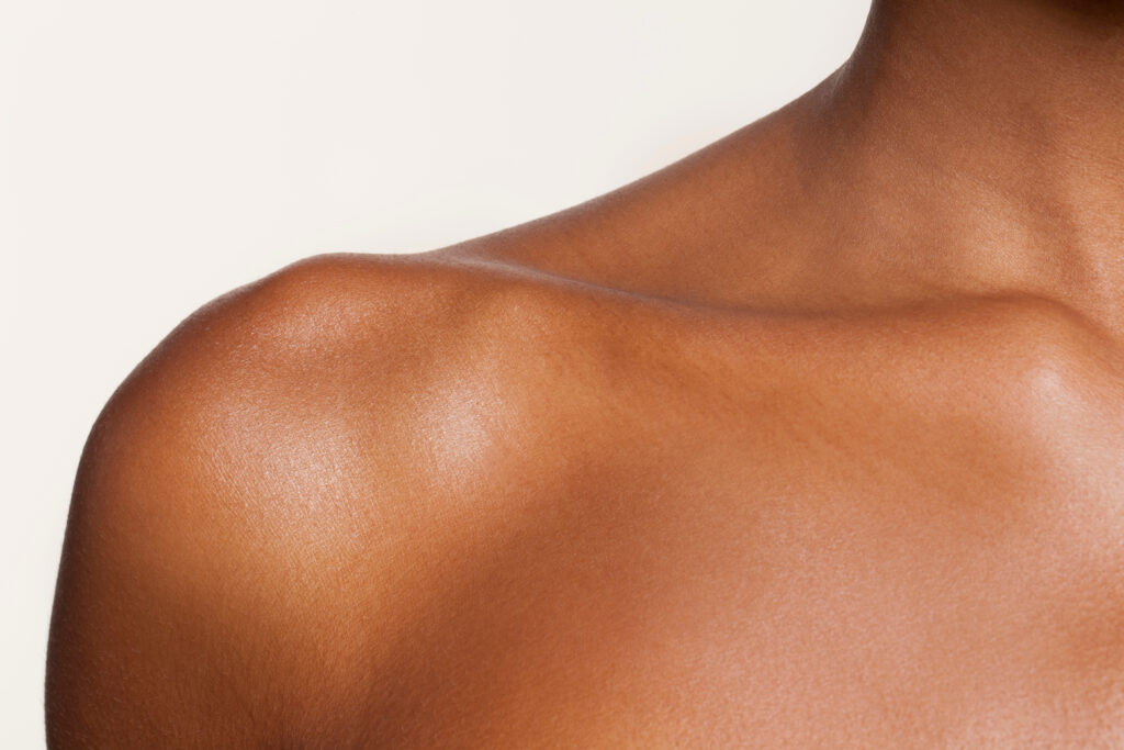 Hands On WEDNESDAY – How to correct an elevated 1st rib with MET ...