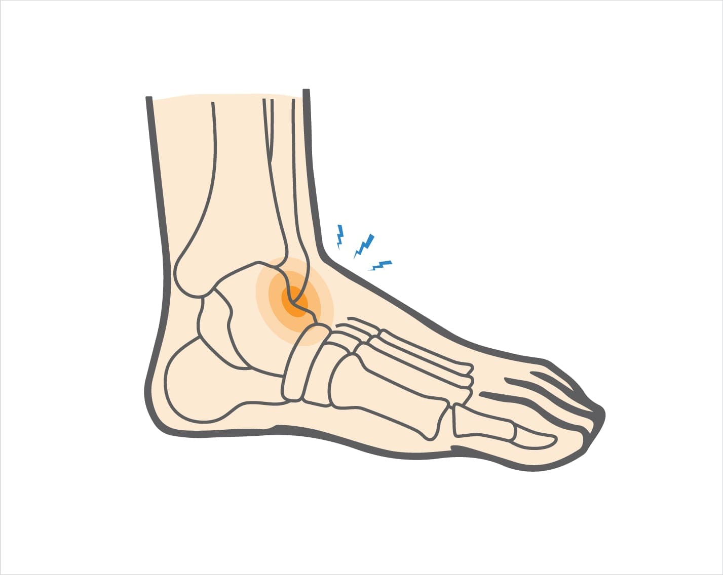 Kinesiology THURSDAY – Ankle Jam and the Bicep Femoris (Why Did That ...