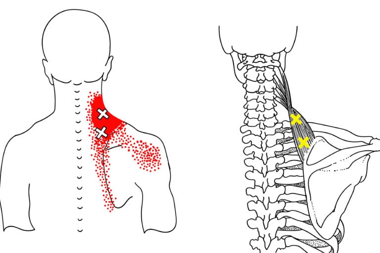 Muscle Minute TUESDAY – Meet the Levator Scapula – Movewell Academy