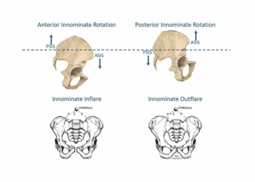 Muscle Minute TUESDAY – Windswept (Part 5 – Innominate Position ...