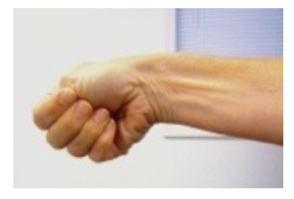 Anatomy TUESDAY – Palpation Series (Part 4 – The Anatomical Snuff Box ...